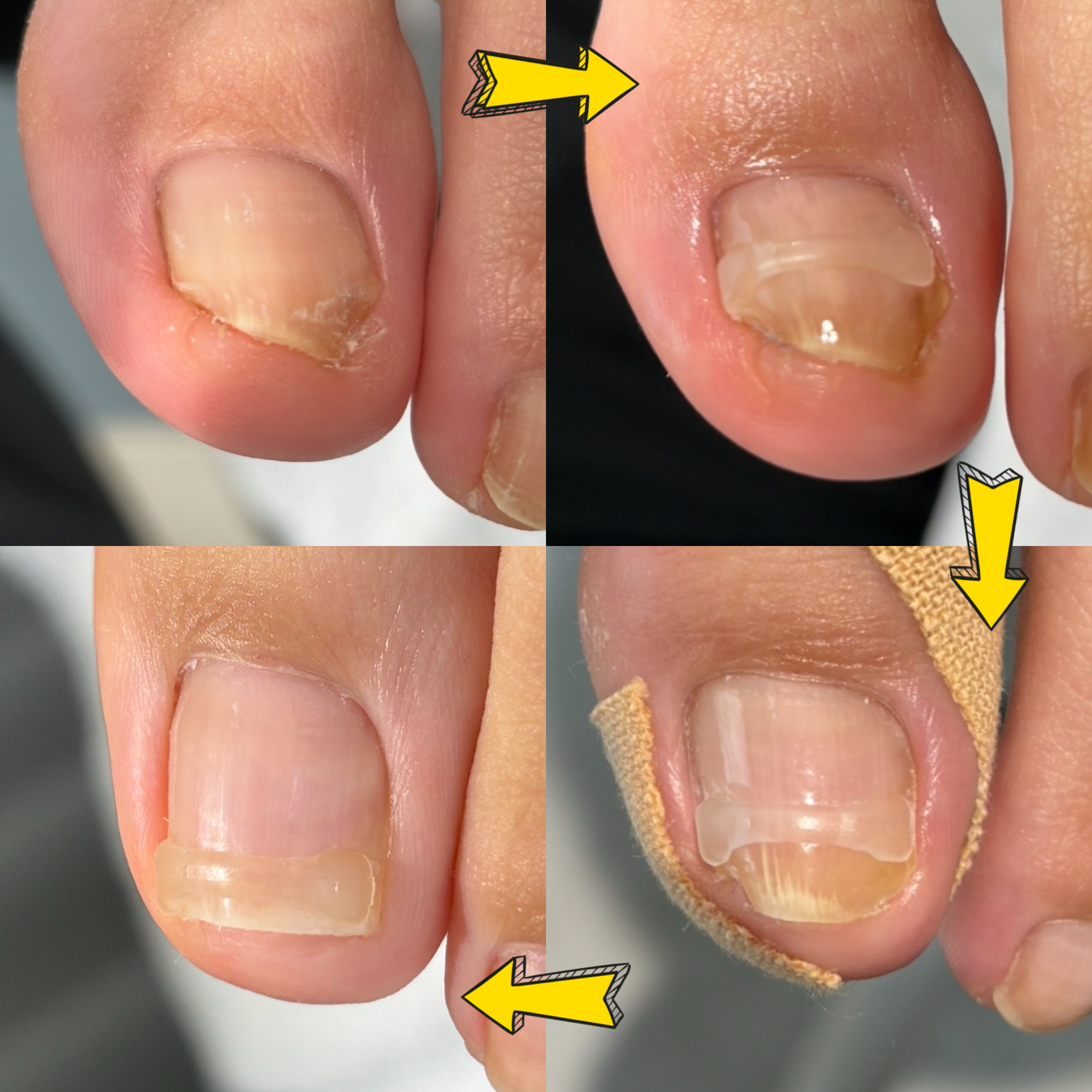 IMG_3314 | Foot Care Salon Runka